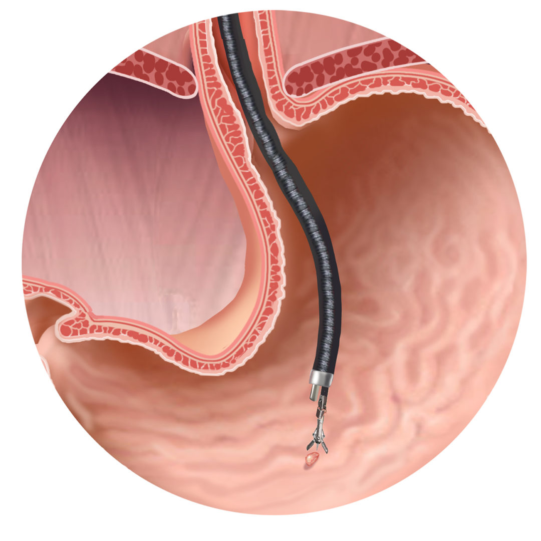 Endoscopy - Jackie Heda | Biomedical & Scientific Visuals